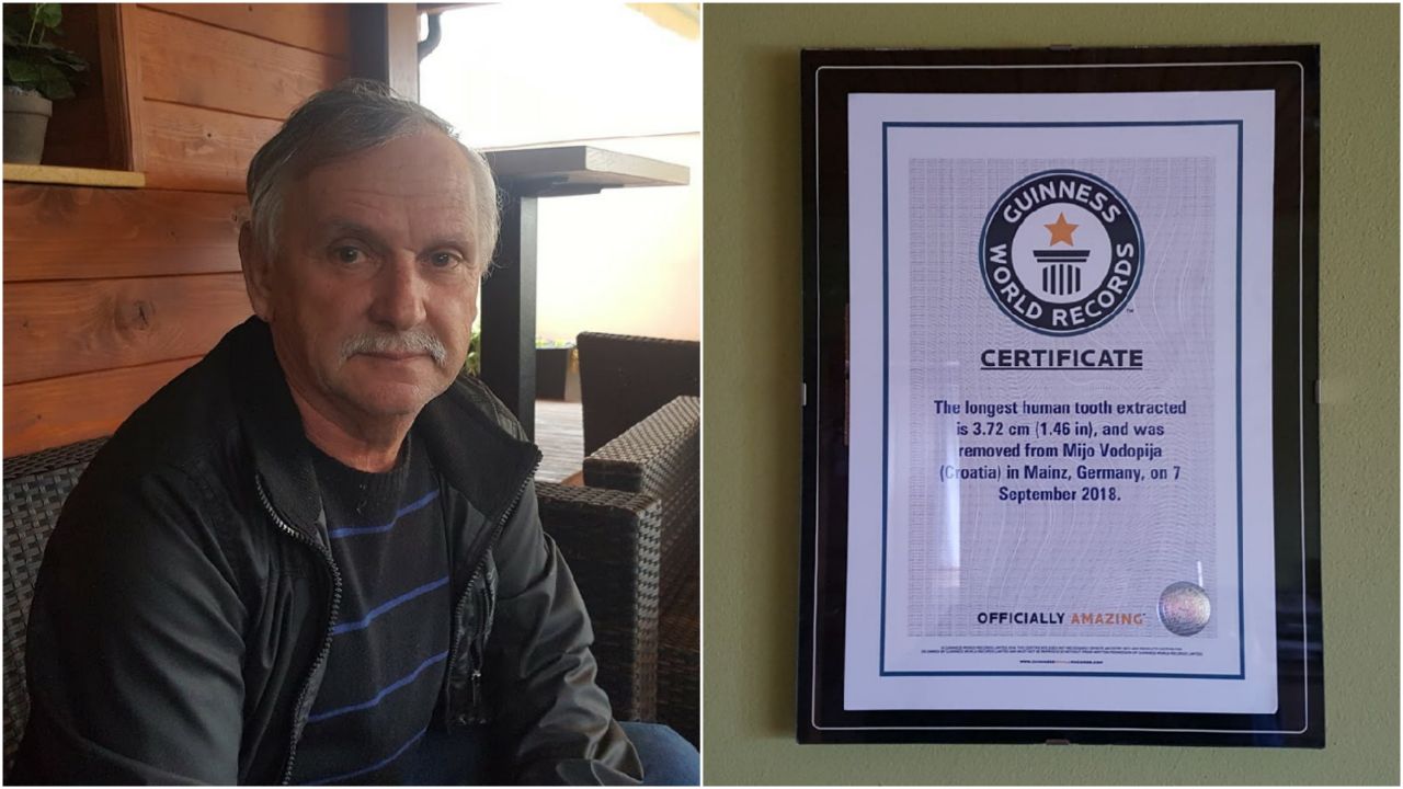 Mijo Vodopija iz Pavlovčana - čovjek s najdužim zubom na svijetu | audio
